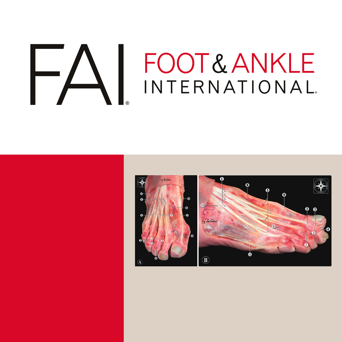 FAI March 2021: Correlating Arthroscopic and Radiographic Findings of ...