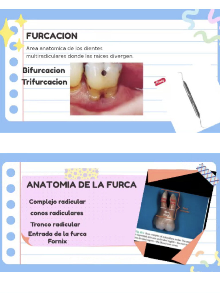 Bolsa y Lesiones de Furca.2025 | PDF