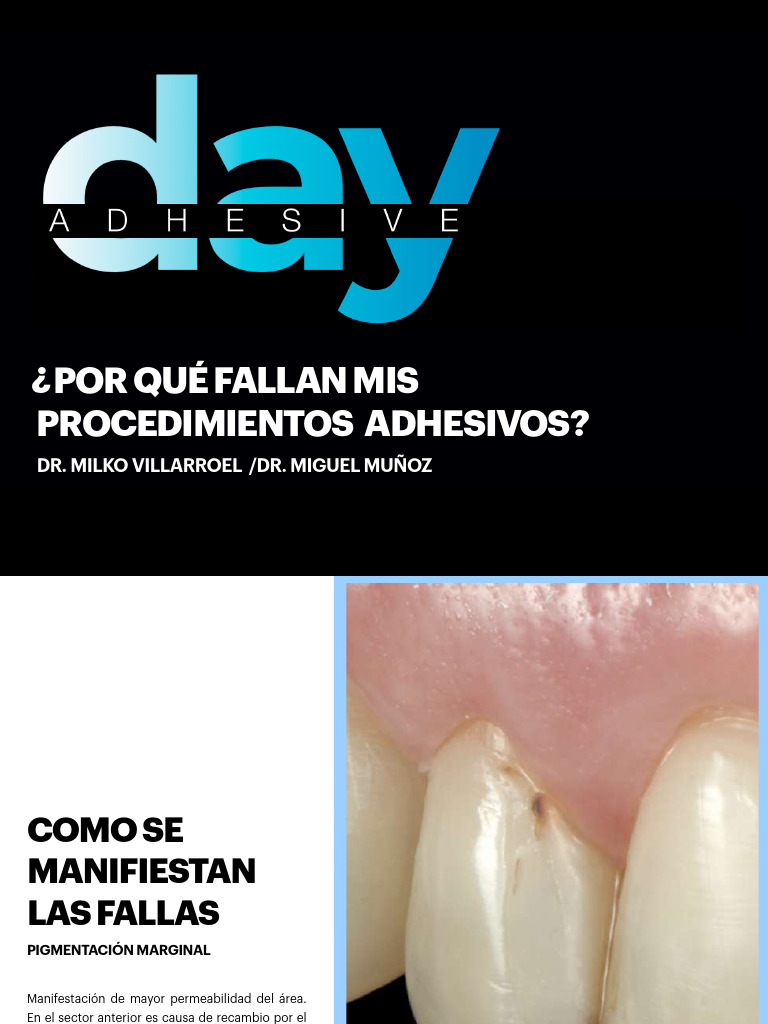 PDF 1 - ¿Por Qué Fallan Mis Procedimientos Adhesivos | PDF | Colágeno ...