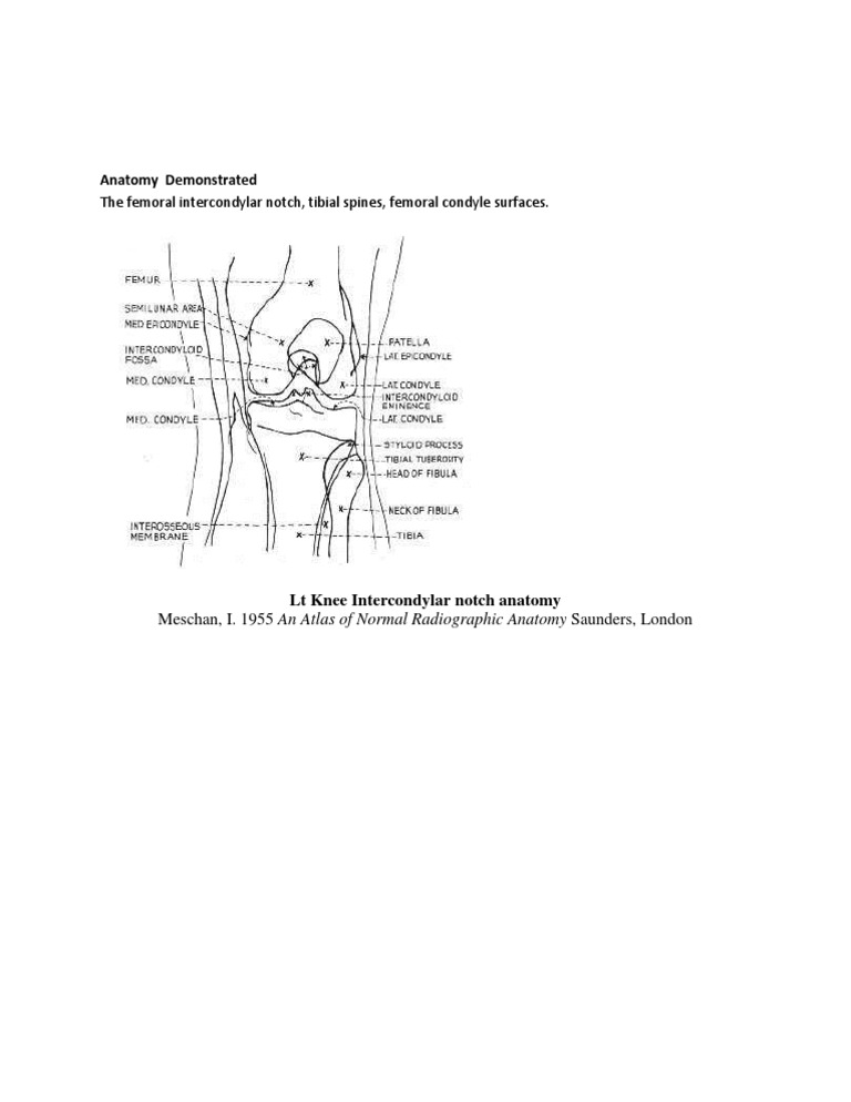 Knee Intercondylar Notch Anatomy Guide | PDF | Social Science