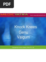 Ureter Kinking: CT Findings and Significance | PDF | Kidney ...