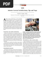Invasive Cervical Traction Gardner Wells Tongs | PDF | Anesthesia ...
