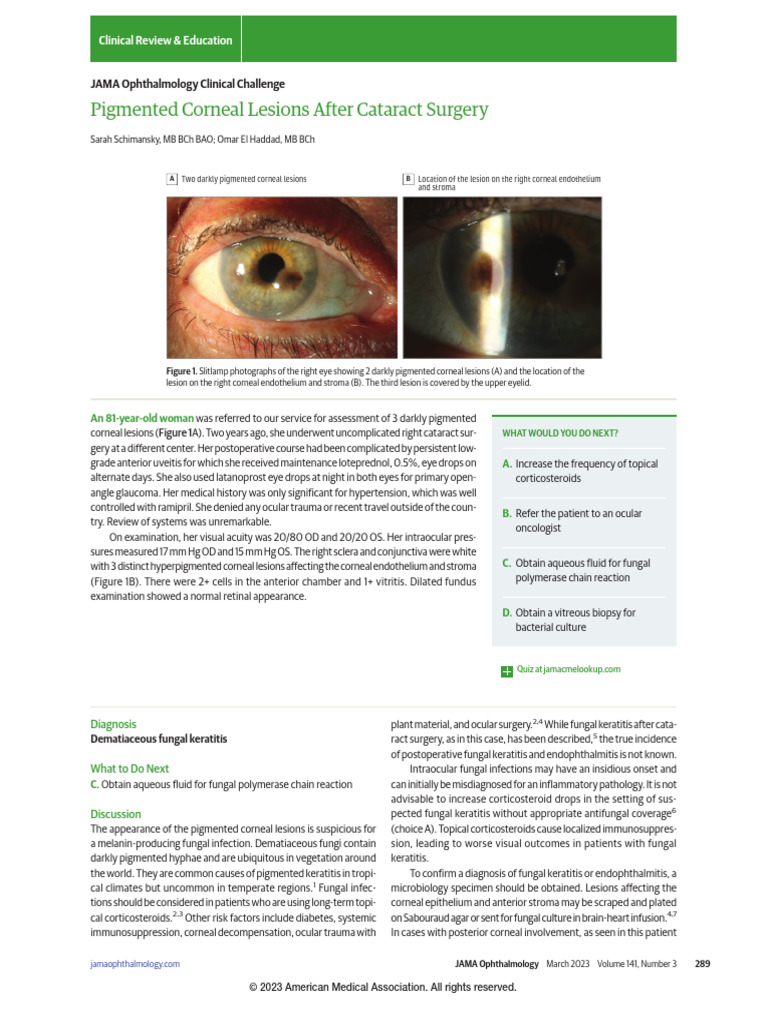 Pigmented Corneal Lesions After Cataract Surgery | PDF | Cornea | Cataract