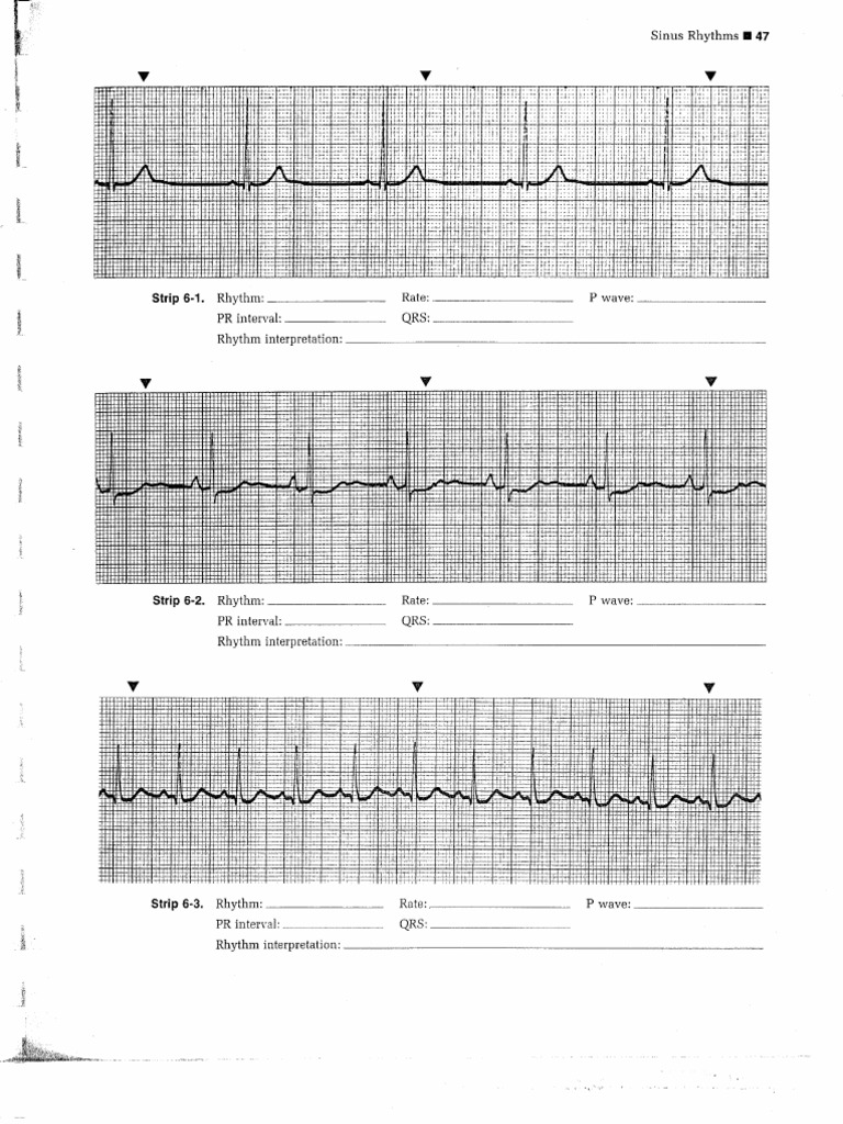 Modele de EKG | PDF | Electrocardiography | Cardiac Arrhythmia
