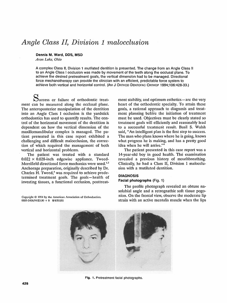 Angle Class II, Division 1 Malocclusion | PDF | Orthodontics | Mouth