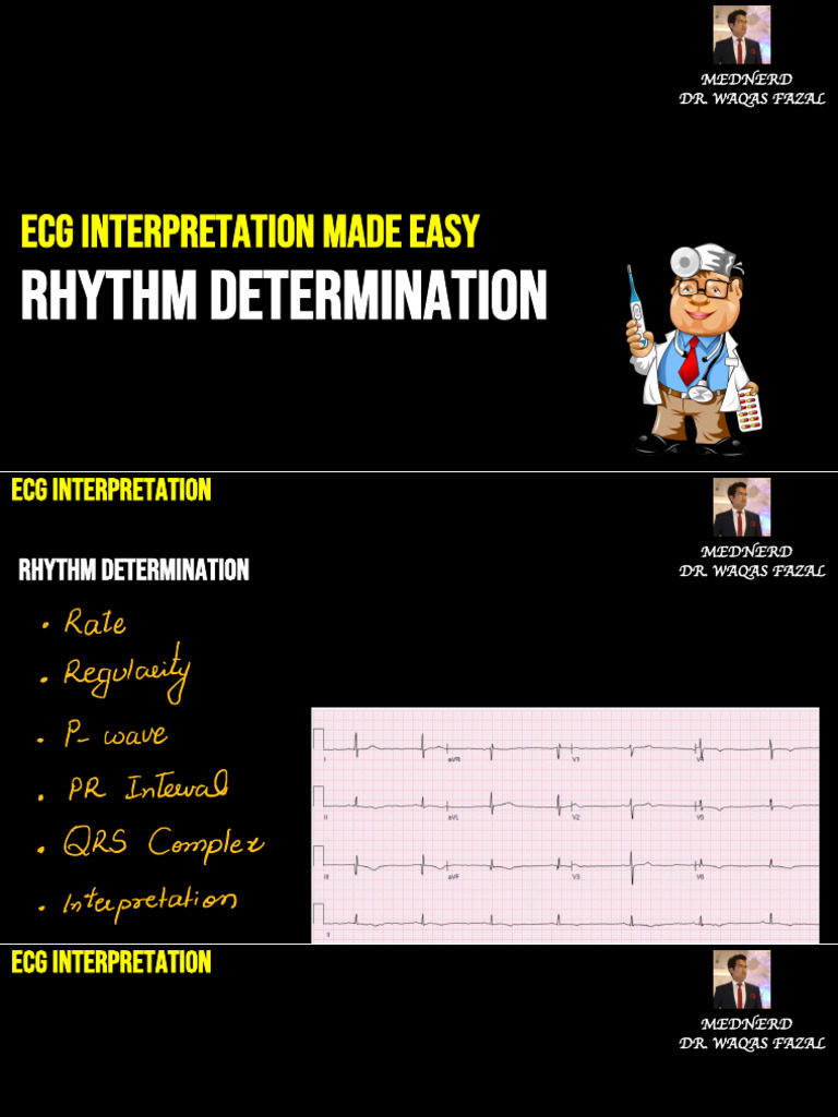 Rhythm Determination ECG Lecture 3 | PDF | Electrocardiography ...