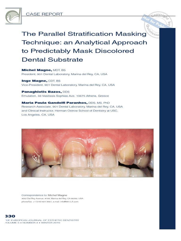 The Parallel Stratification Masking Technique - An Analytical Approach ...
