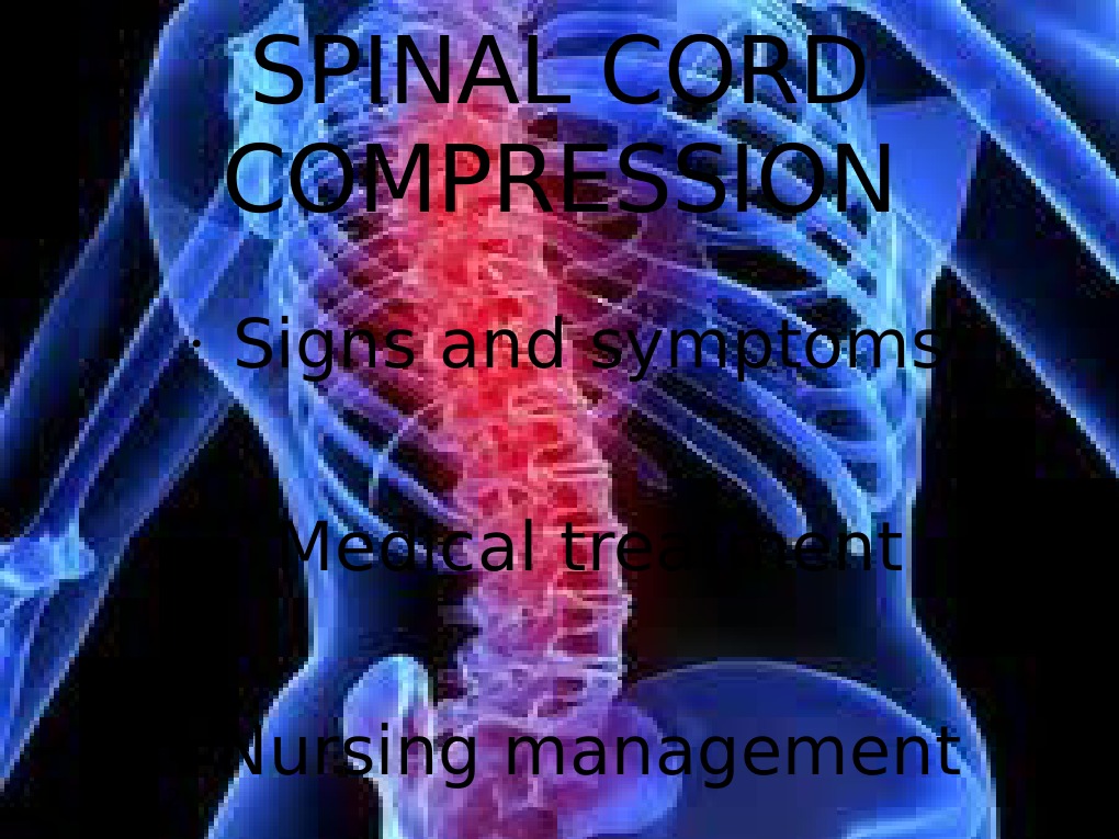Spinal Cord Compression | PDF | Vertebral Column | Pain