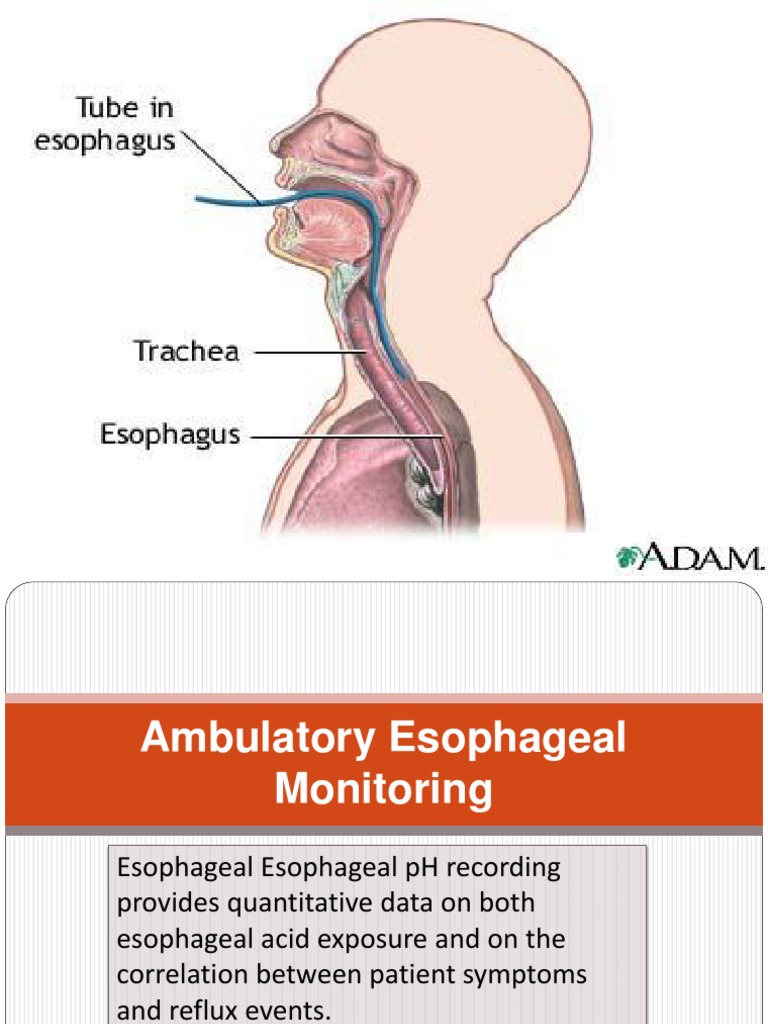 Ambulatory Esophageal Monitoring.pptx | Gastroesophageal Reflux Disease ...