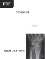 Hand X-Ray Projections Guide | PDF | Hand | Finger