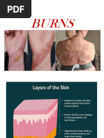 TBSA Burn Estimation for 2nd & 3rd Degree | PDF | Arm | Human Anatomy