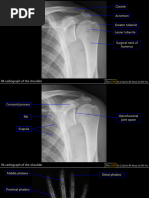 2023 X-Ray CPT Code Reference Guide | PDF | Home & Garden