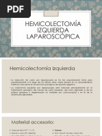 Técnicas Quirúrgicas: Hartmann y Miles | PDF | Cáncer colonrectal | Cirugía
