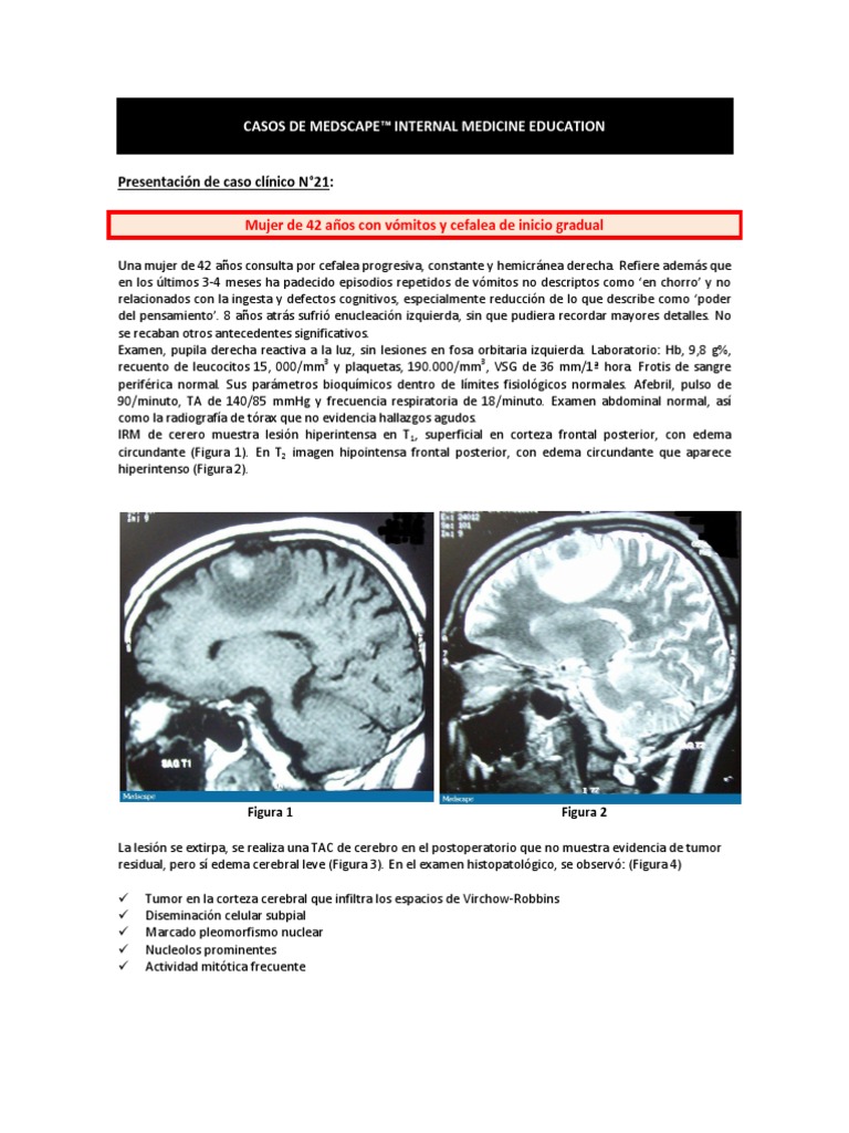 Casos de Medscape | PDF | Metástasis | Melanoma