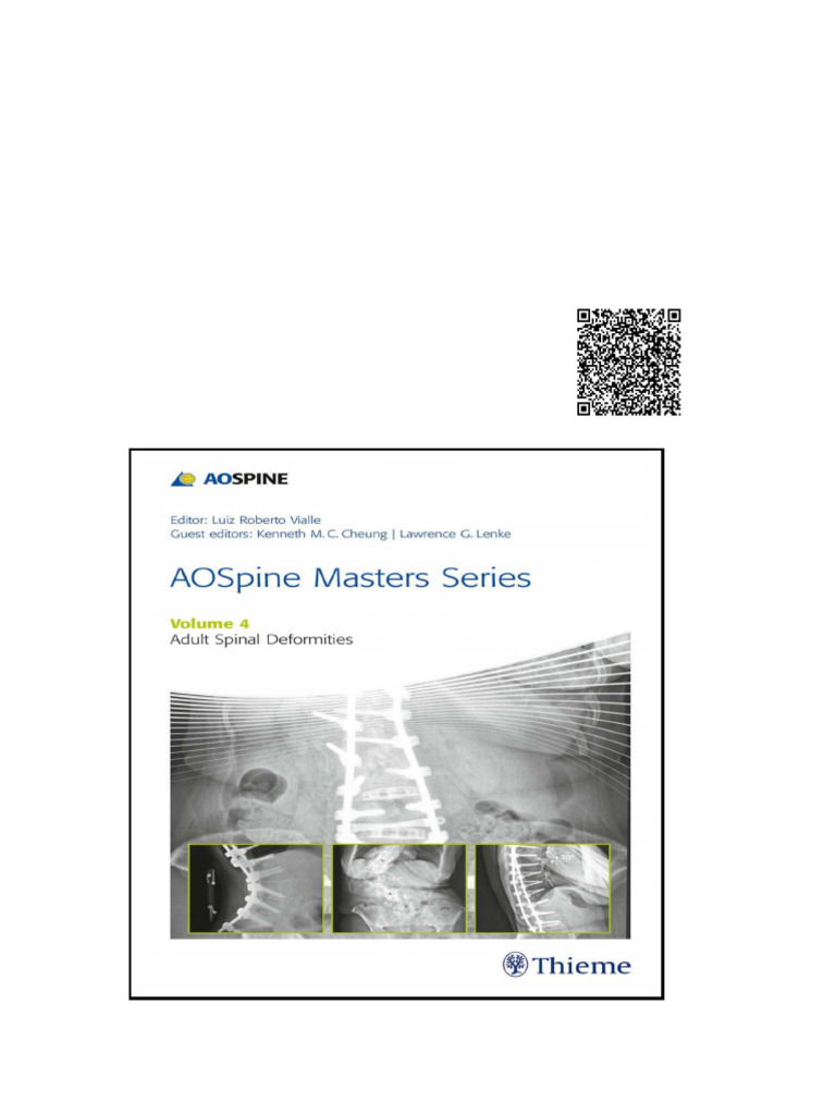 AOSpine Masters Series Volume 4 Adult Spinal Deformities | PDF | World ...