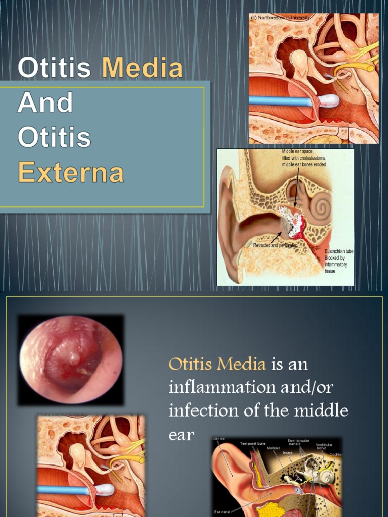 Otitis Externa Vs Otitis Media
