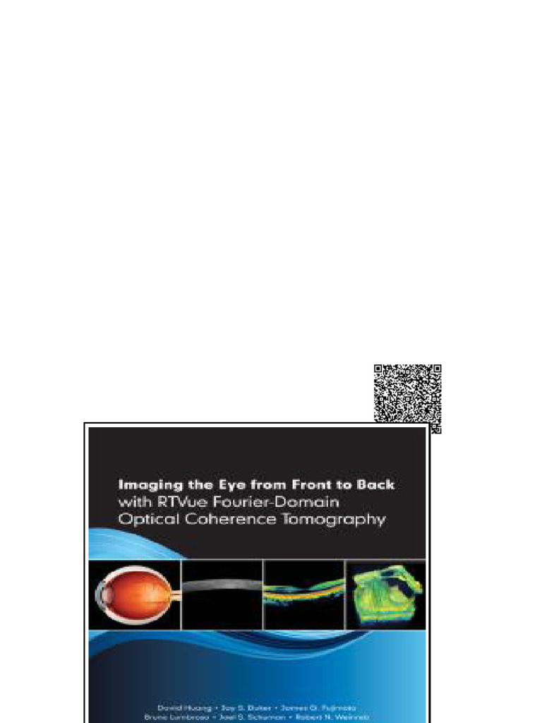 (Ebook) Imaging the Eye from Front to Back with RTVue Fourier-Domain ...