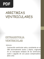 Trigeminismo Ventricular: Definición y Tratamiento | PDF