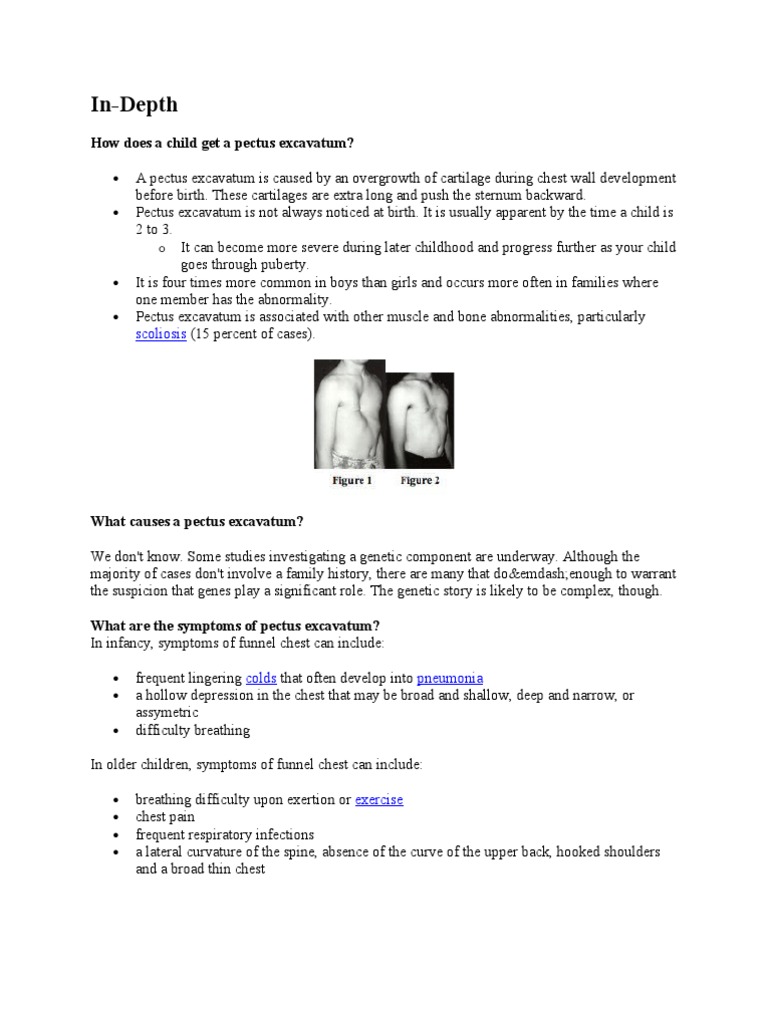 In-Depth: How Does A Child Get A Pectus Excavatum? | PDF | Medical ...
