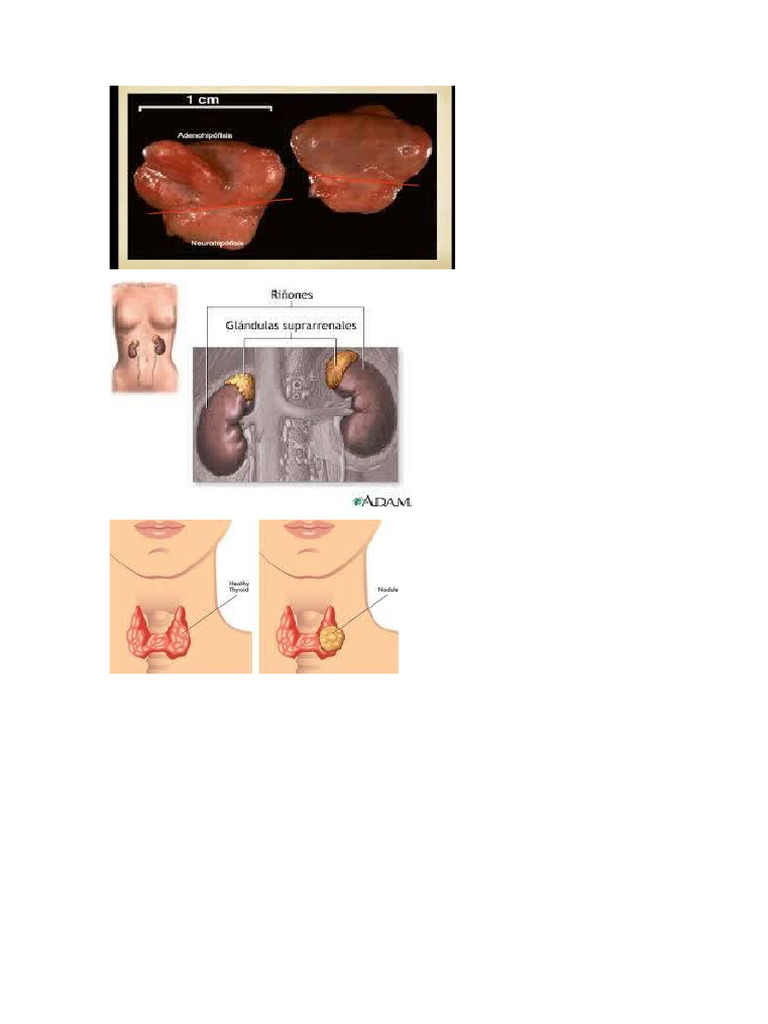 Histo 1 | PDF