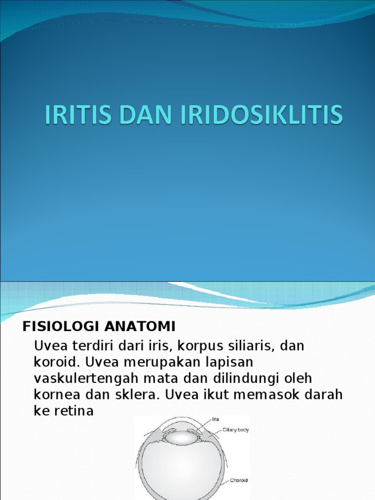 Iritis Dan Iridosiklitis | PDF