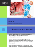 Exposicion Vaginitis Aguda | PDF | Candidiasis | Medicina