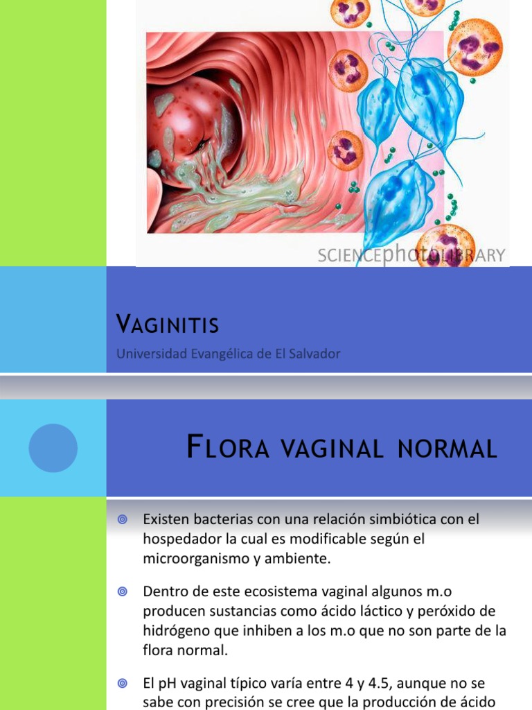 Vaginitis | PDF | Vagina | Especialidades Medicas