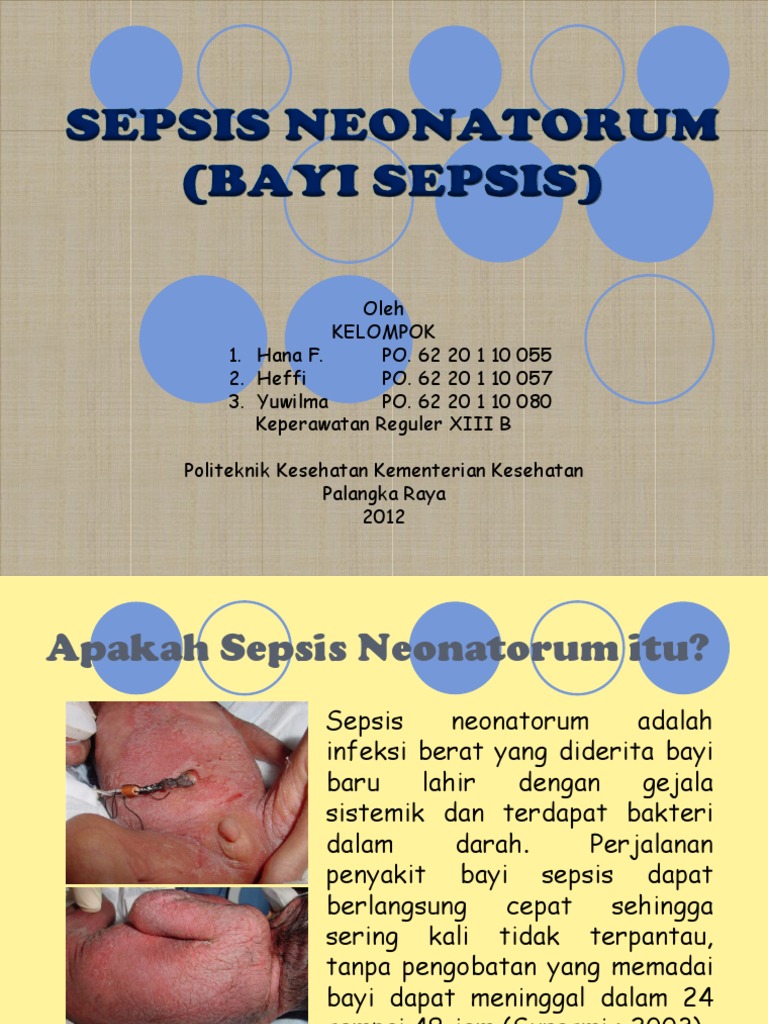 Sepsis Neonatorum (Bayi Sepsis) | PDF