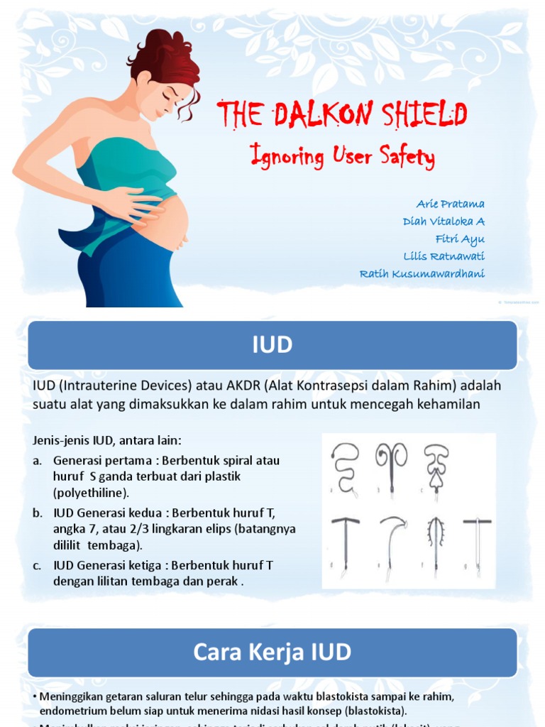 The Dalkon Shield | PDF