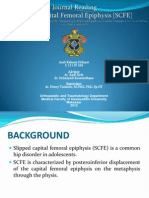 Drehmann Sign and Femoro Acetabular Impingement In.7 | PDF | Hip ...