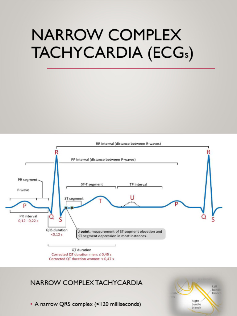 Narrow Complex Tachycardias | PDF | Electrocardiography | Atrium (Heart)
