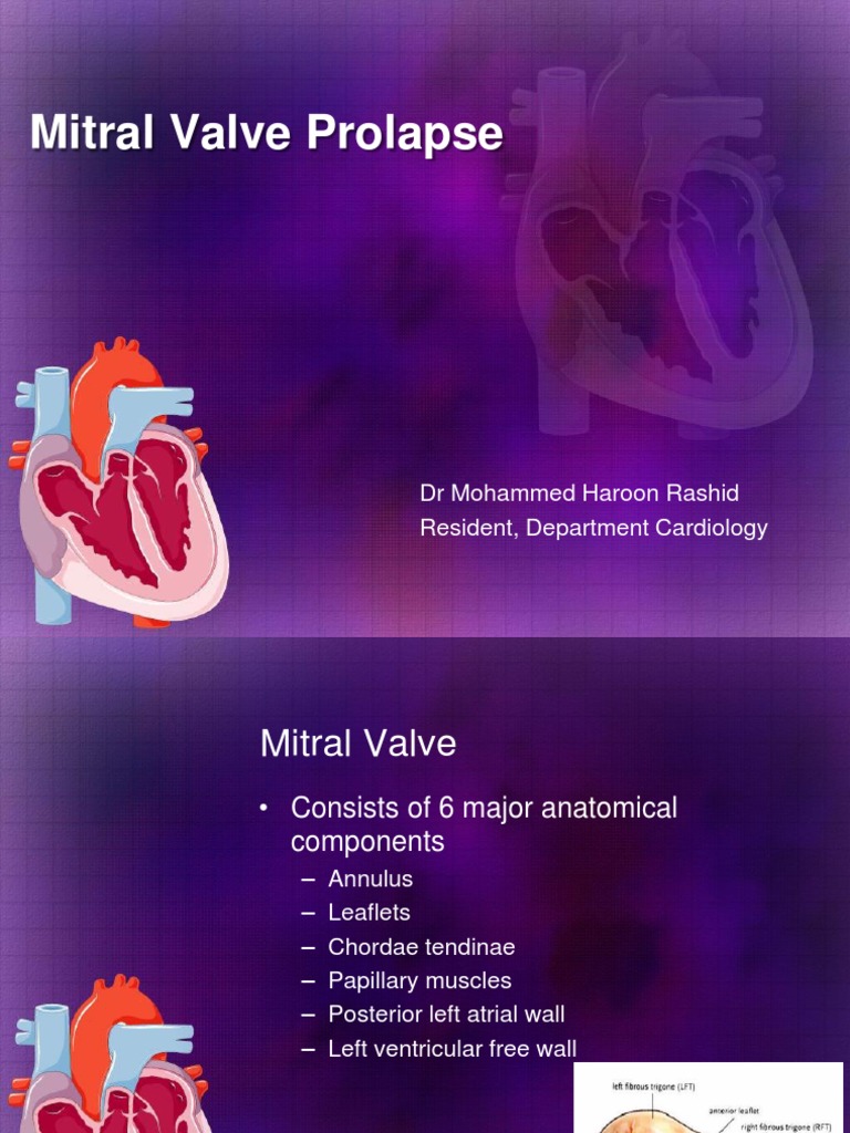 Understanding Mitral Valve Prolapse | PDF | Heart Valve ...