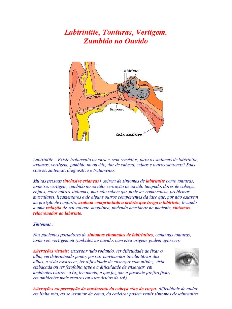 Labirintite: Causas e Tratamentos | PDF