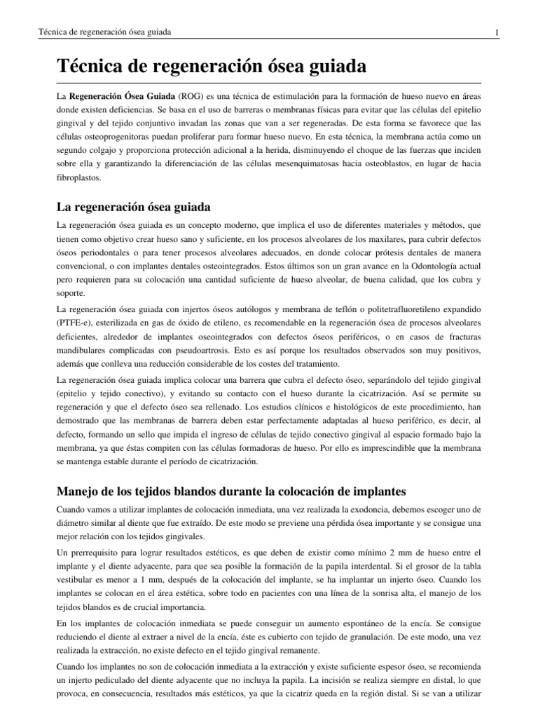 Regeneracion Osea Guiada Regeneracion Osea Guiada