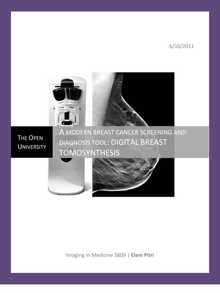 Digital Breast Tomosynthesis | PDF | Mammography | Medical Imaging