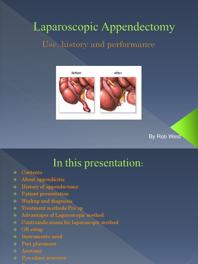 Laparoscopic Appendectomy Port Placement