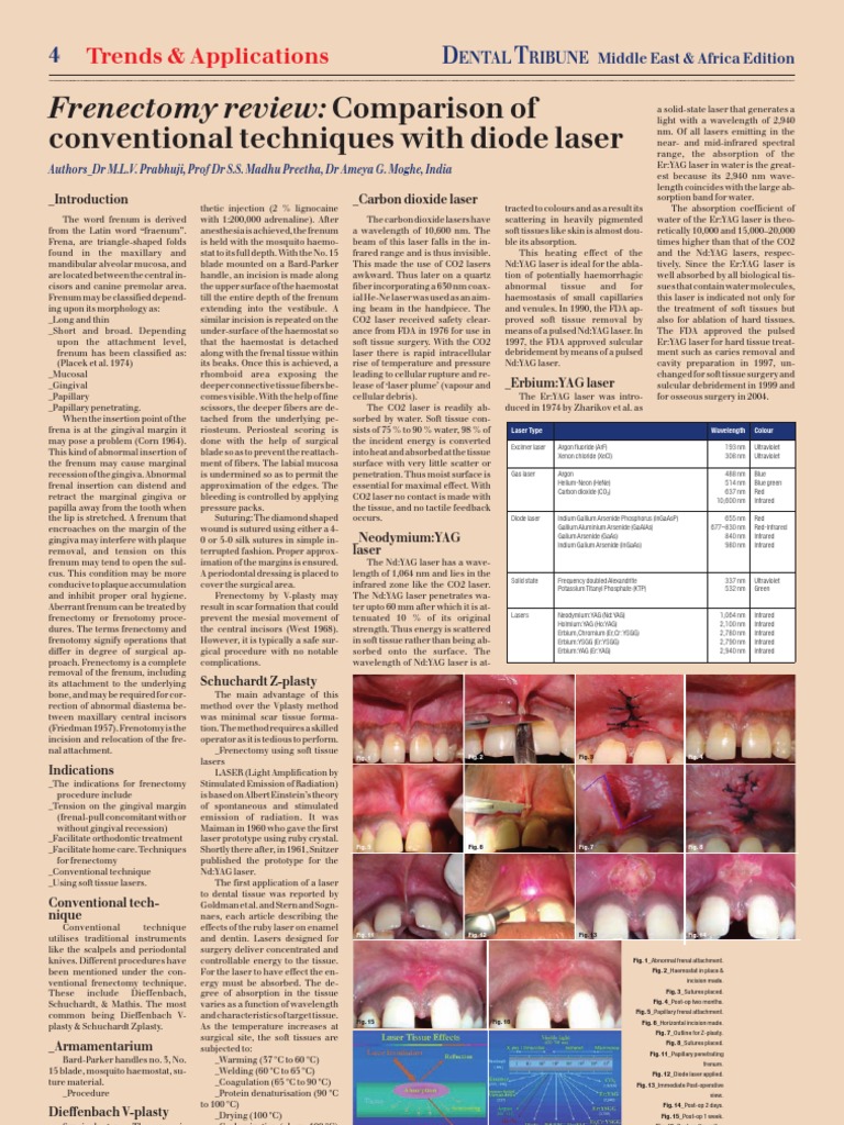 Frenectomy | PDF | Laser | Infrared