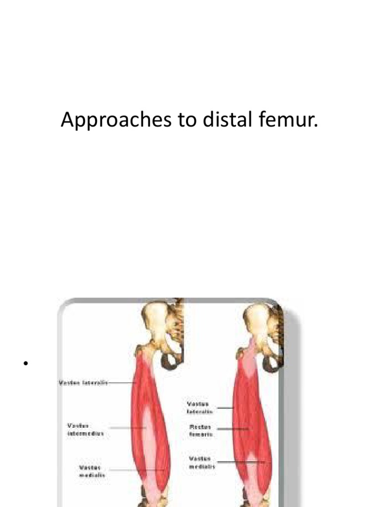 Approaches To Distal Femur | PDF | Anatomical Terms Of Location | Lower ...
