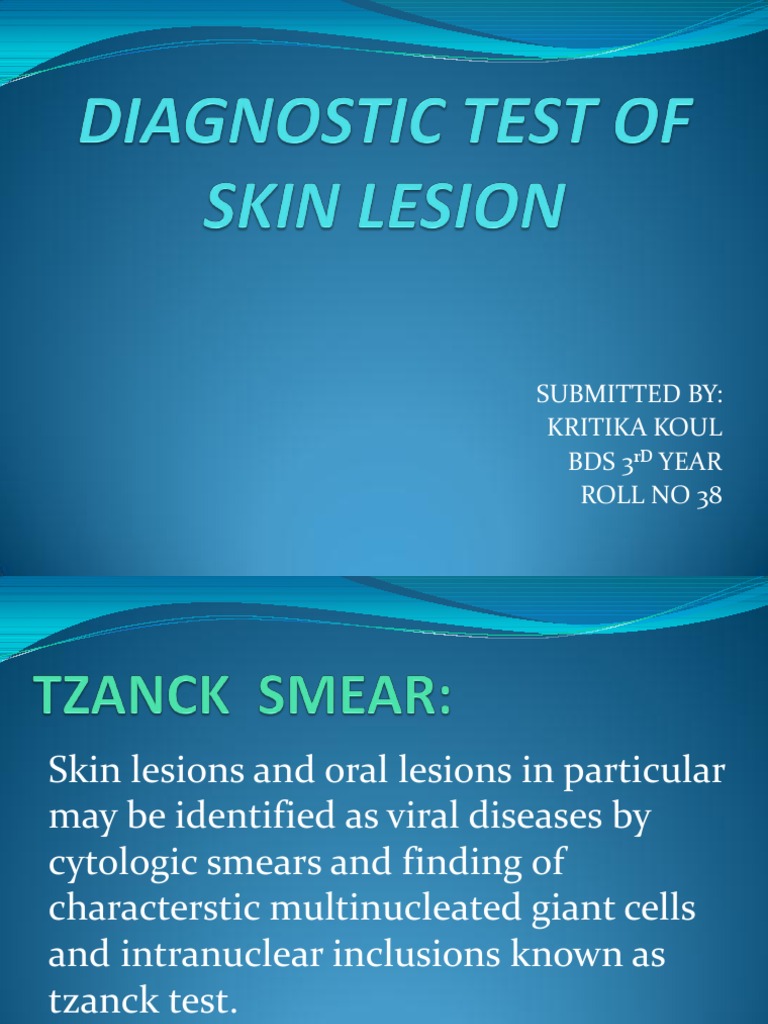 38 Tzanck Smear,Auspitz Sign ,Nikolsky Sign, Le Cell $ Koebners ...