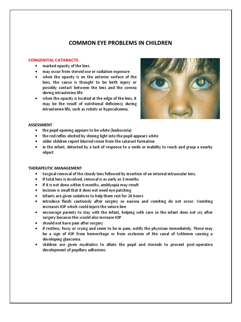 Common Eye Problems in Children | PDF | Medical Specialties | Ophthalmology