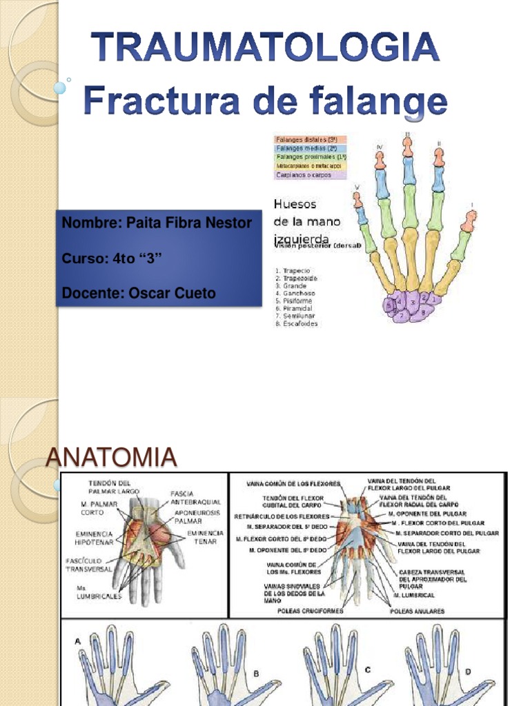 Fracturas de Falange Distal y Tratamiento | PDF