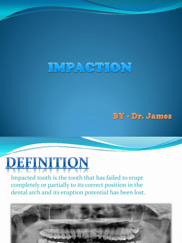 IMPACTION | PDF | Human Tooth | Tooth