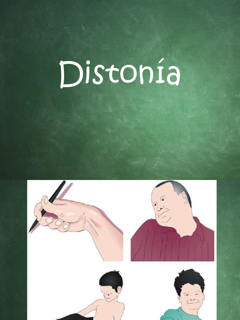 Tipos y causas de distonía | PDF | Distonia | Enfermedades y trastornos ...