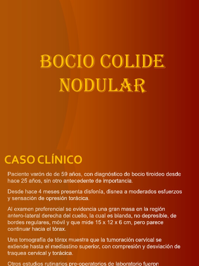 Bocio Coloide Nodular | PDF