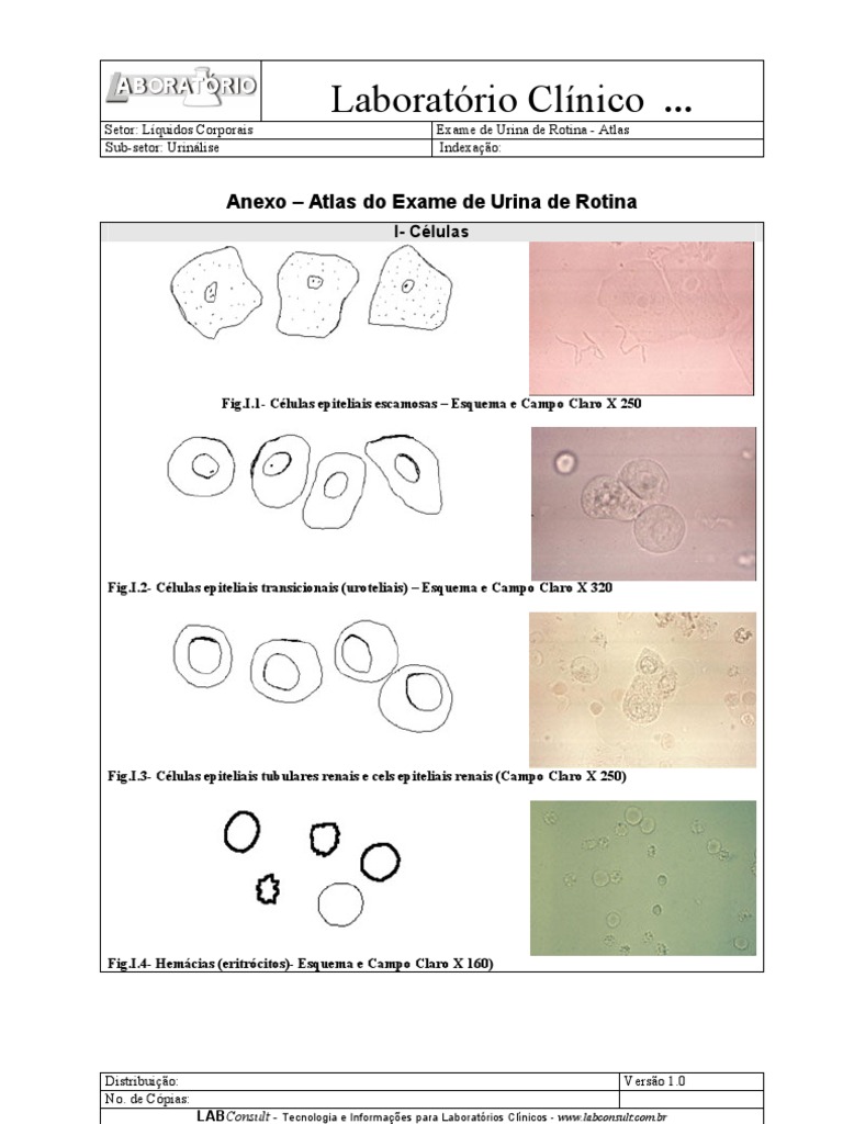 Atlas Do Exame de Urina de Rotina | PDF | Excreção | Urologia