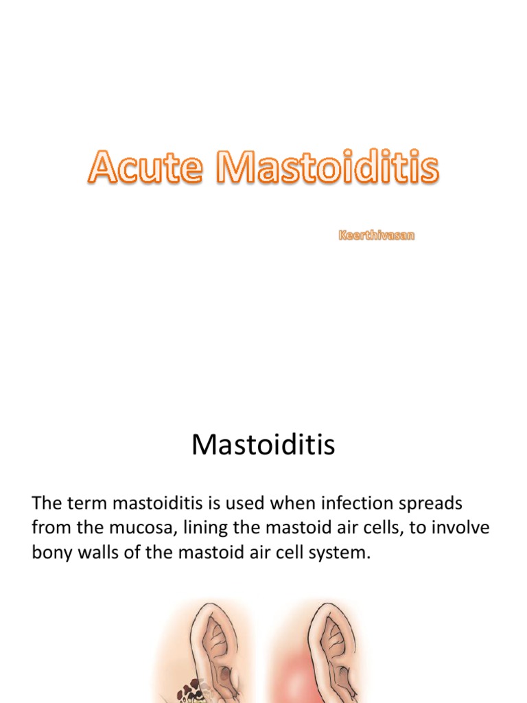 Acute Mastoiditis | Medical Specialties | Diseases And Disorders