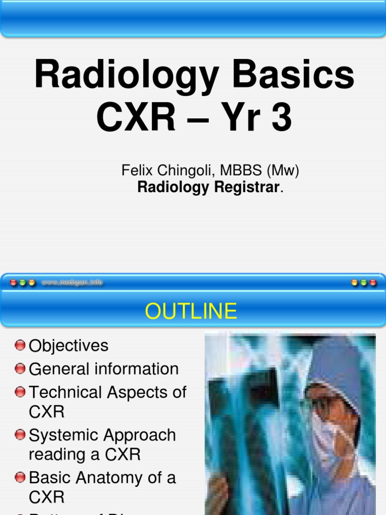 How To Read A Goofy Chest X Ray Mbbs | PDF | Lung | Thorax