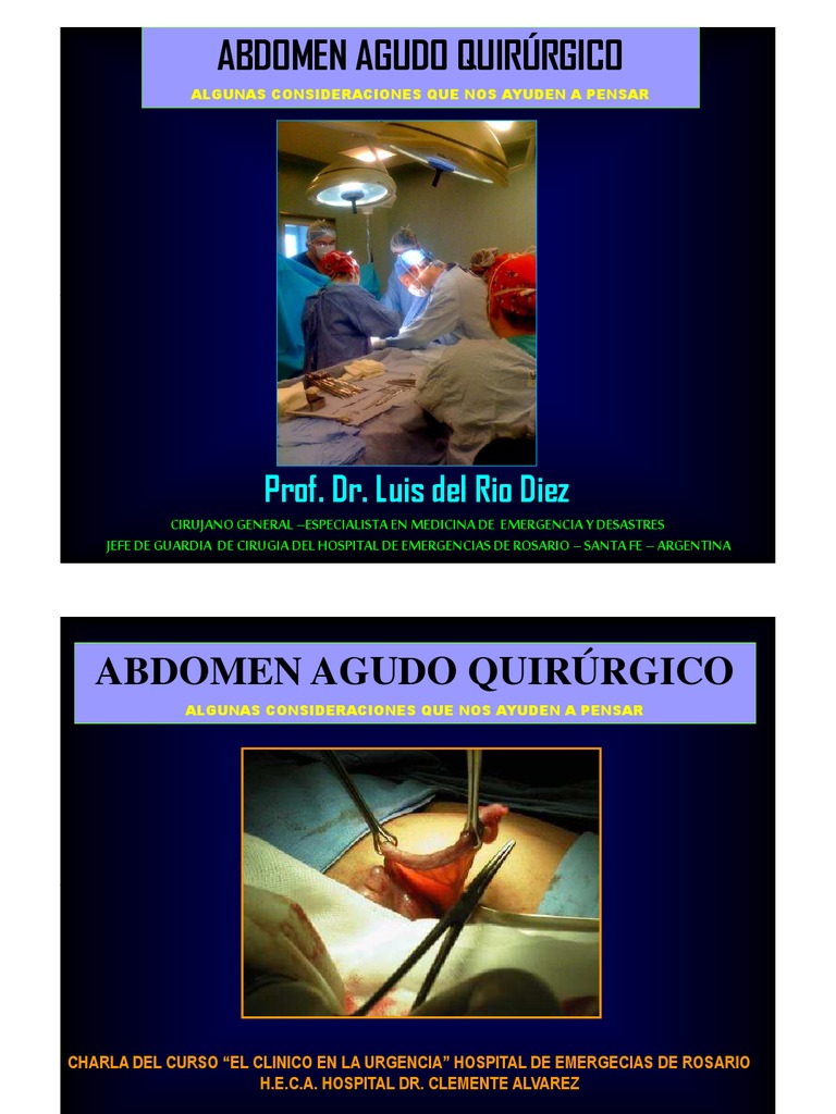 ABDOMEN AGUDO QUIRÚRGICO ALGUNAS REFLEXIONES QUE NOS AYUDEN A PENSAR ...