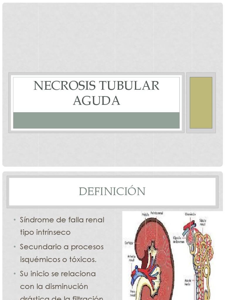 NECROSIS TUBULAR AGUDA | Especialidades Medicas | Medicina CLINICA