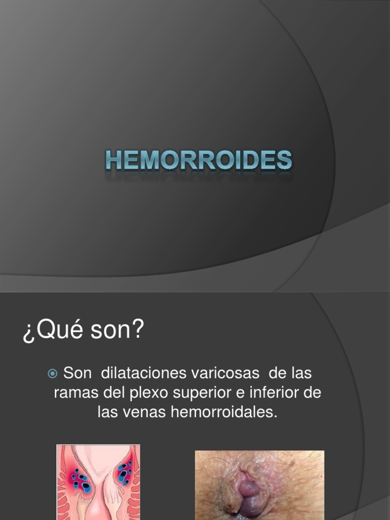 Hemorroides | PDF | Hemorroides | Rtt